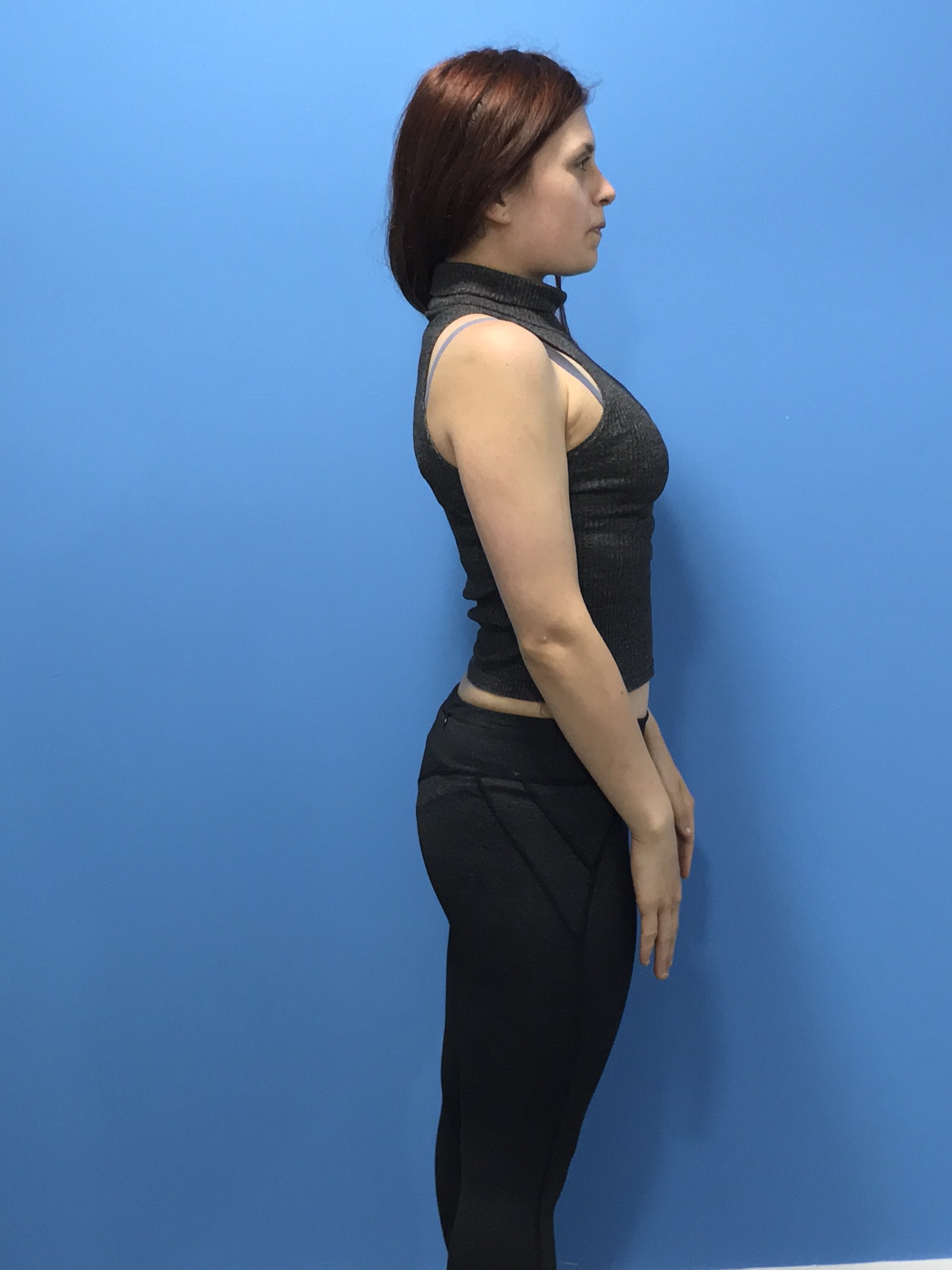 Posture Analysis – Rejuvenate Sports Therapy