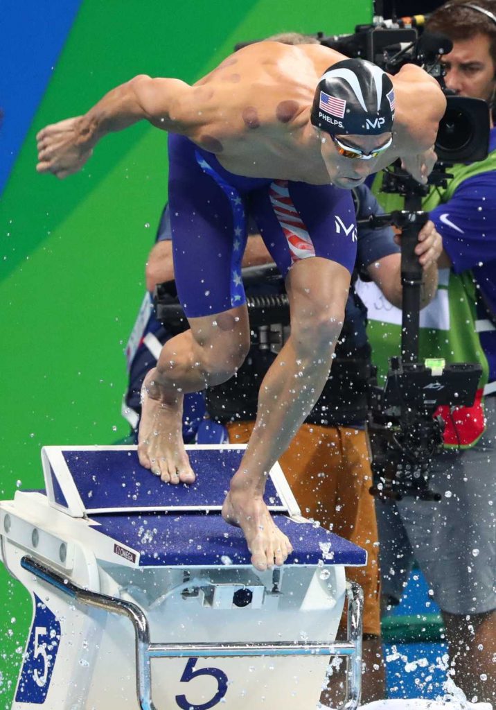 Cupping – Rejuvenate Sports Therapy